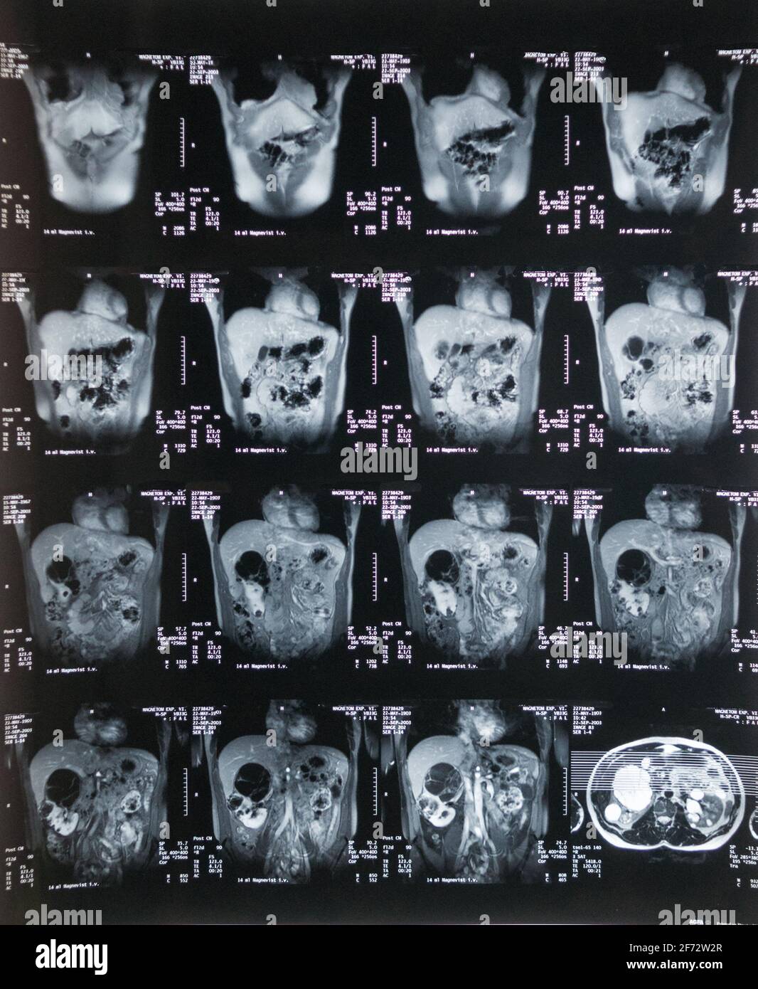 Imagerie par résonance magnétique, IRM, tomodensitométrie, imagerie ...