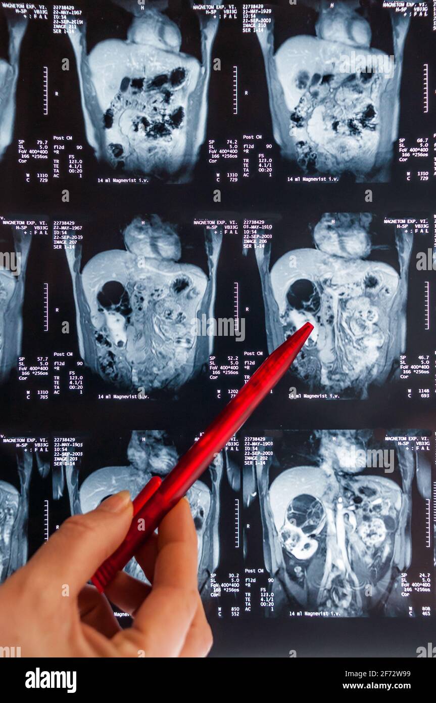 Imagerie par résonance magnétique, IRM, tomodensitométrie, imagerie ...