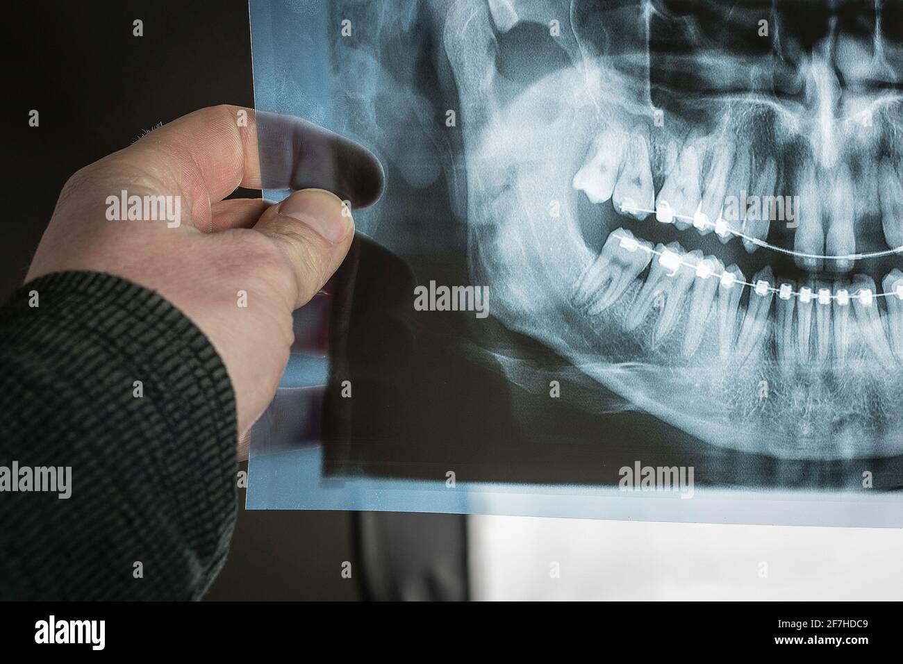 Main est visible tenant une radiographie dentaire d'une personne avec ...