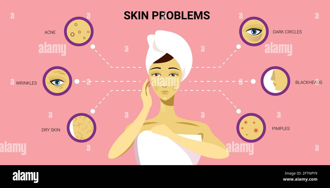 boutons de peau faciale acné différents types sur le visage de la femme ...