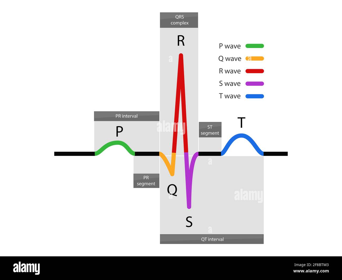 Courbe ecg, dépolarisation auriculaire et ventriculaire normale avec ...