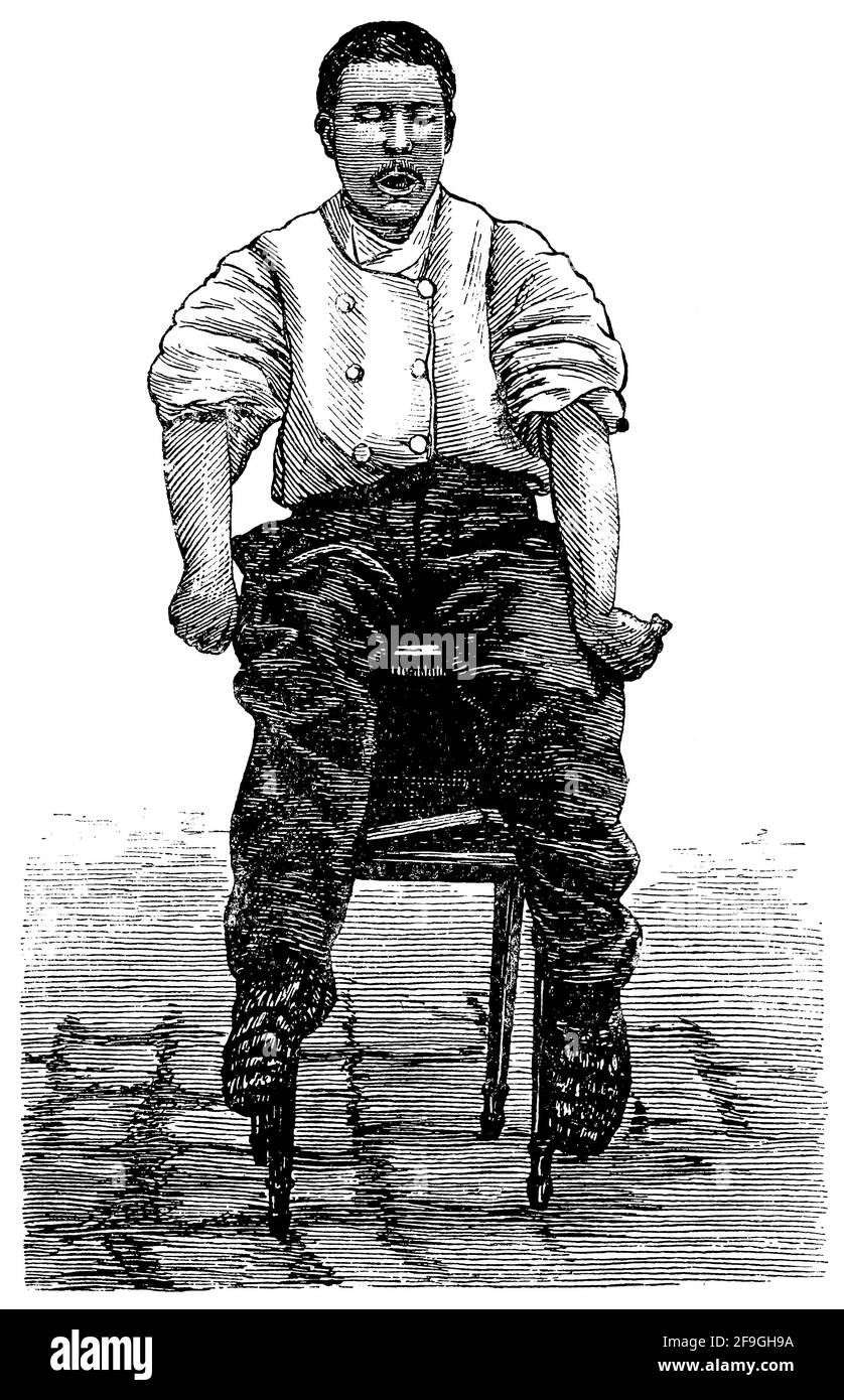 Insanity treatment Banque de photographies et d’images à haute ...