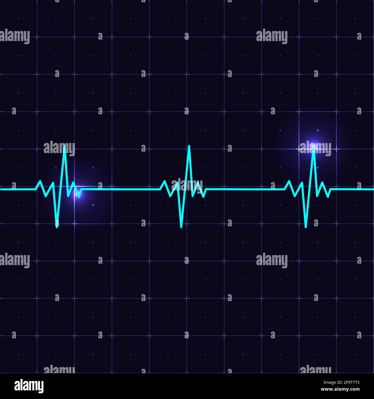Cardiogramm. Pulsation cardiaque avec écran réaliste et effet de ...