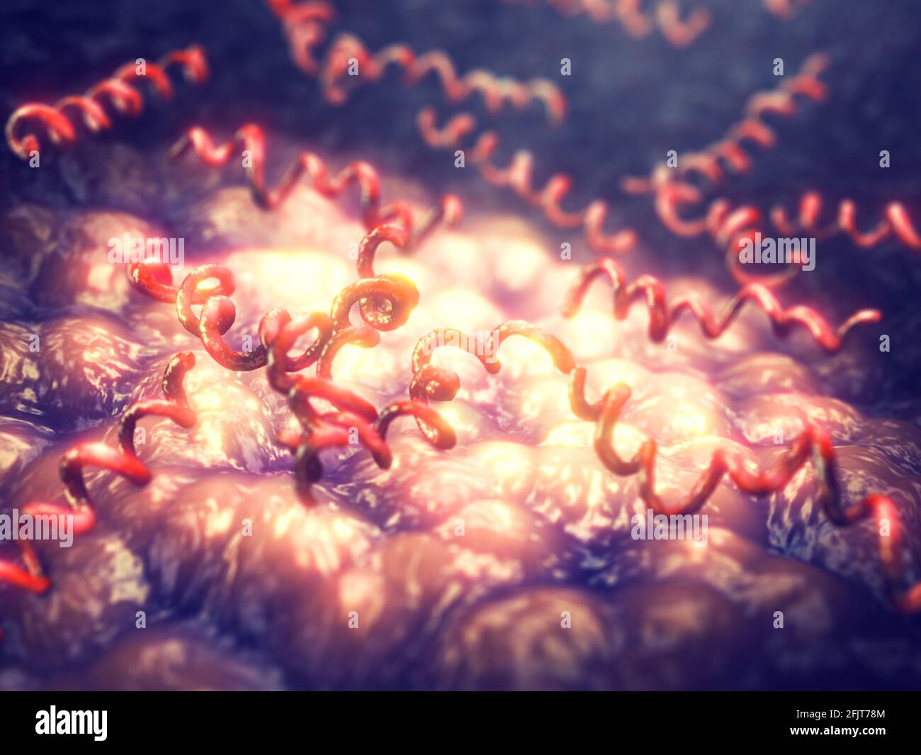 La syphilis est une infection sexuellement transmissible causée par la ...