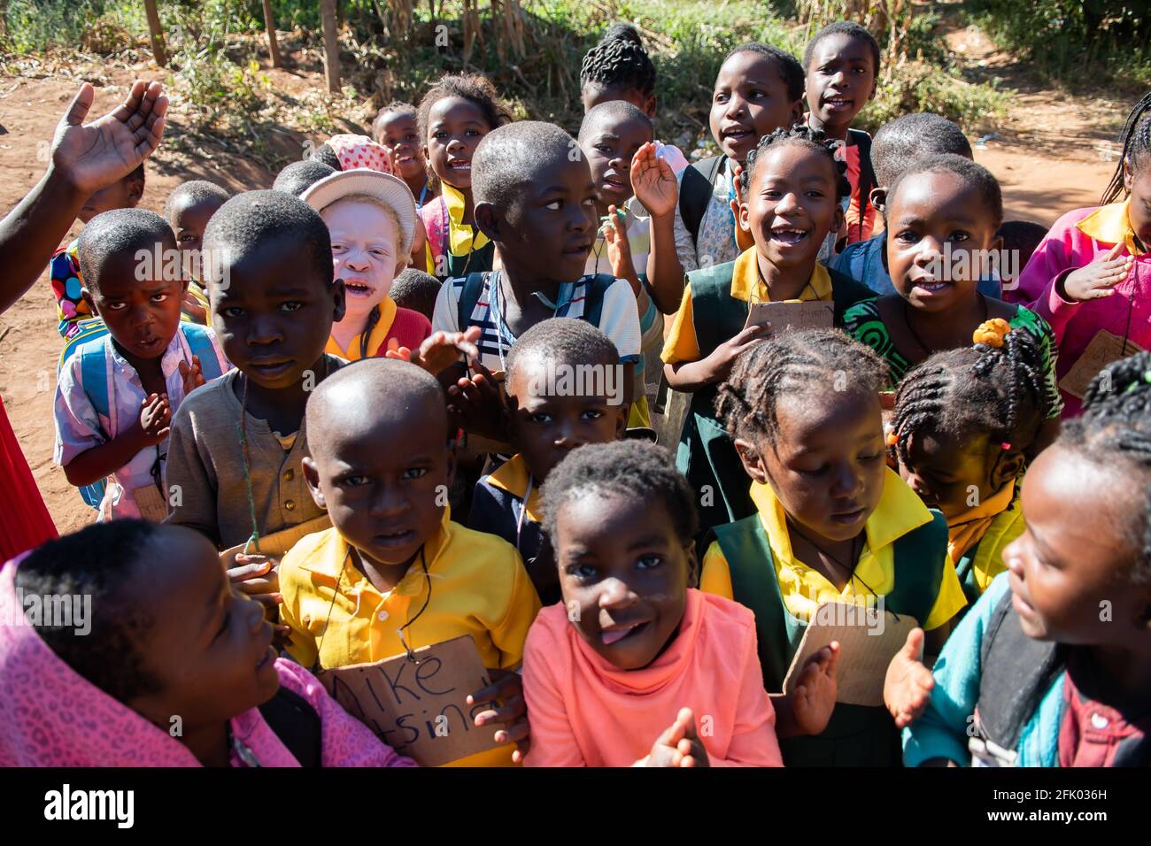 Black children albinos Banque de photographies et d’images à haute ...