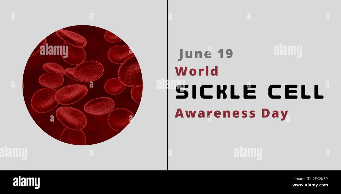 Sickle cell Banque de photographies et d’images à haute résolution - Alamy