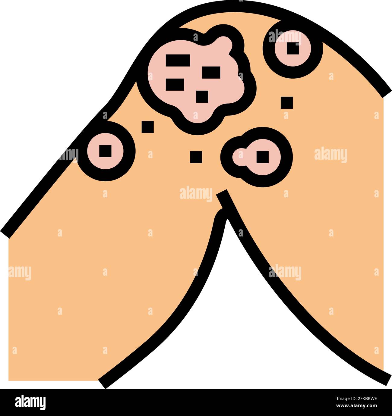 Dermatite de stase Banque de photographies et d’images à haute ...