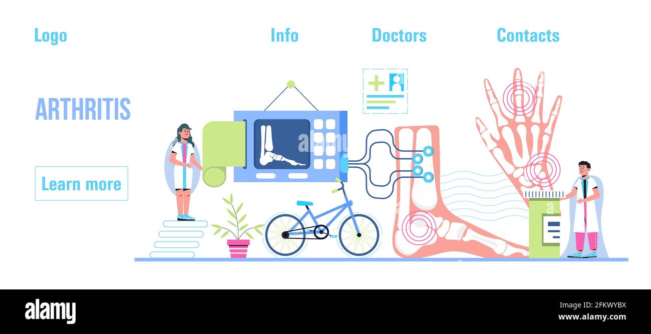 Polyarthrite rhumatoïde. Les médecins minuscules traitent le rhumatisme ...