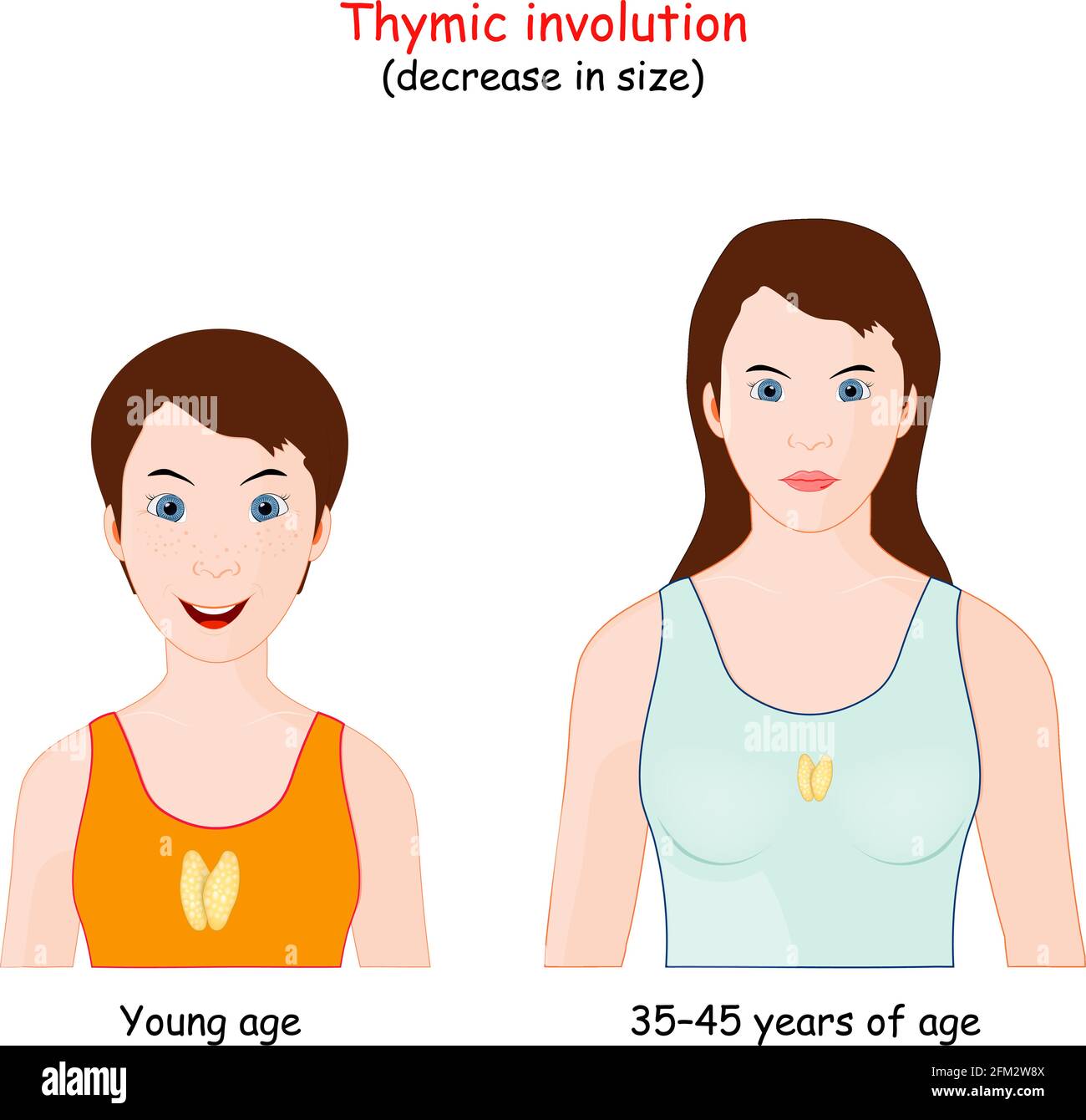 Involution thymique. Diminuer la taille du thymus avec l'âge ...
