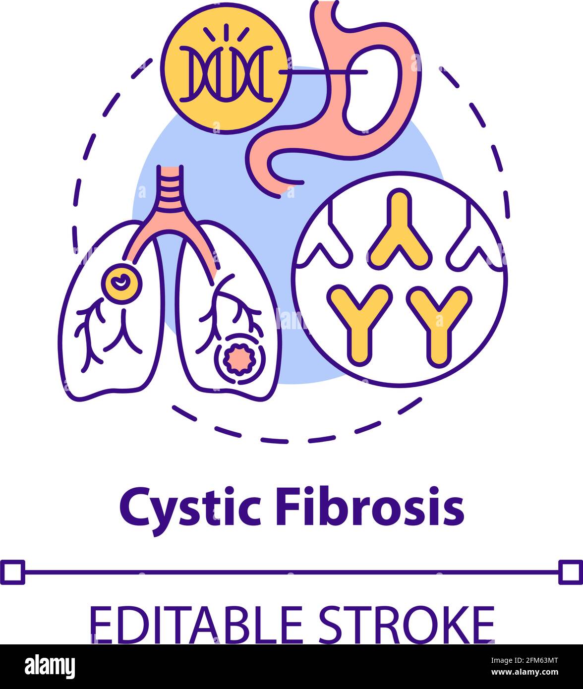 Maladie de la fibrose kystique Banque d'images vectorielles - Alamy