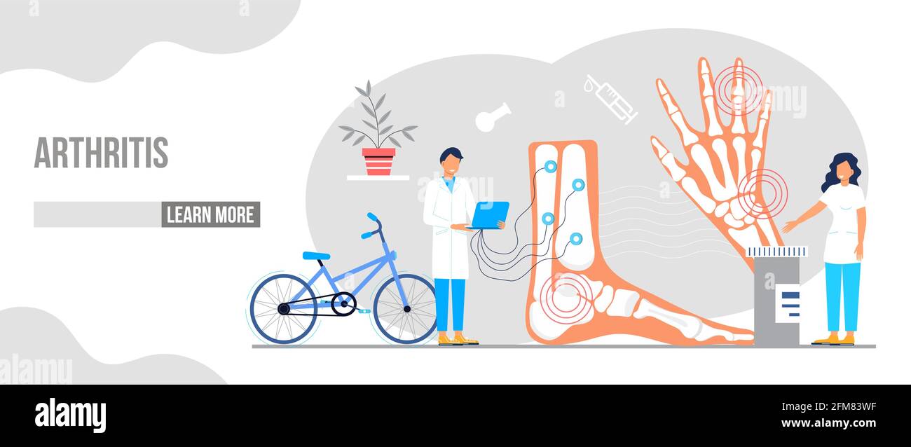 Polyarthrite rhumatoïde du pied. Les médecins minuscules traitent le ...