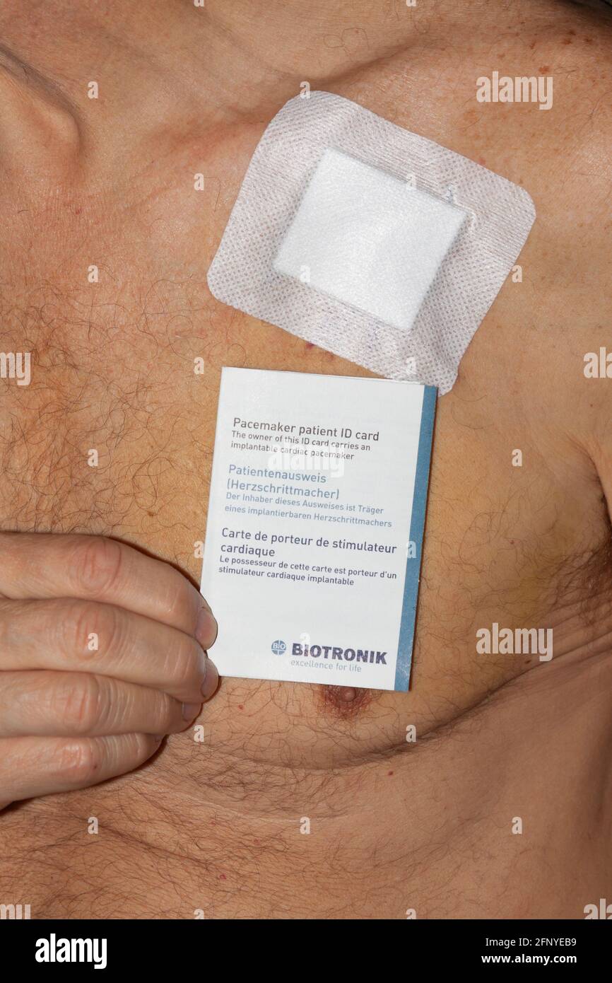 Pacemaker implantation Banque de photographies et d’images à haute ...