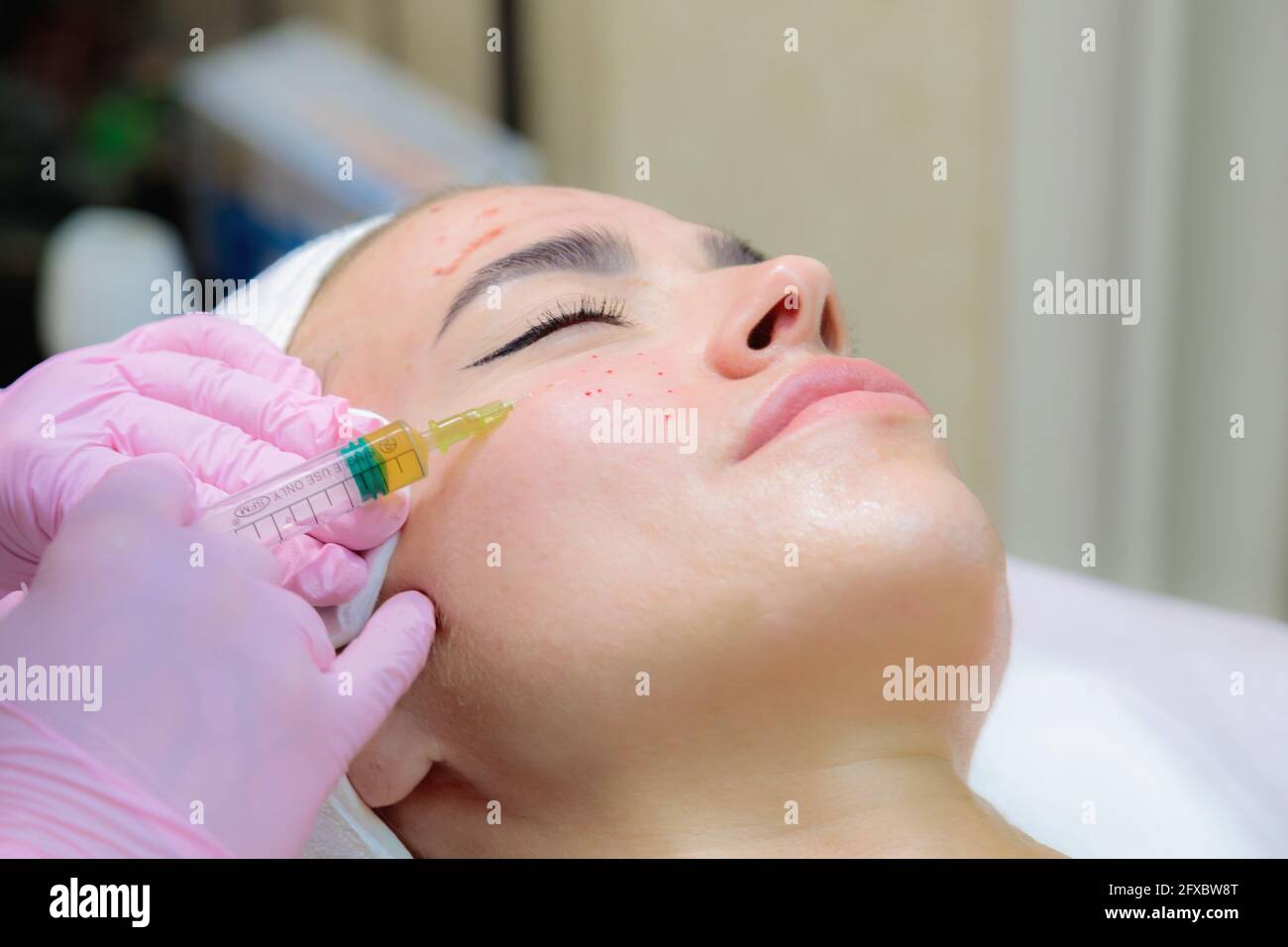 Le médecin donne des injections de plasma sanguin dans le visage d'une ...