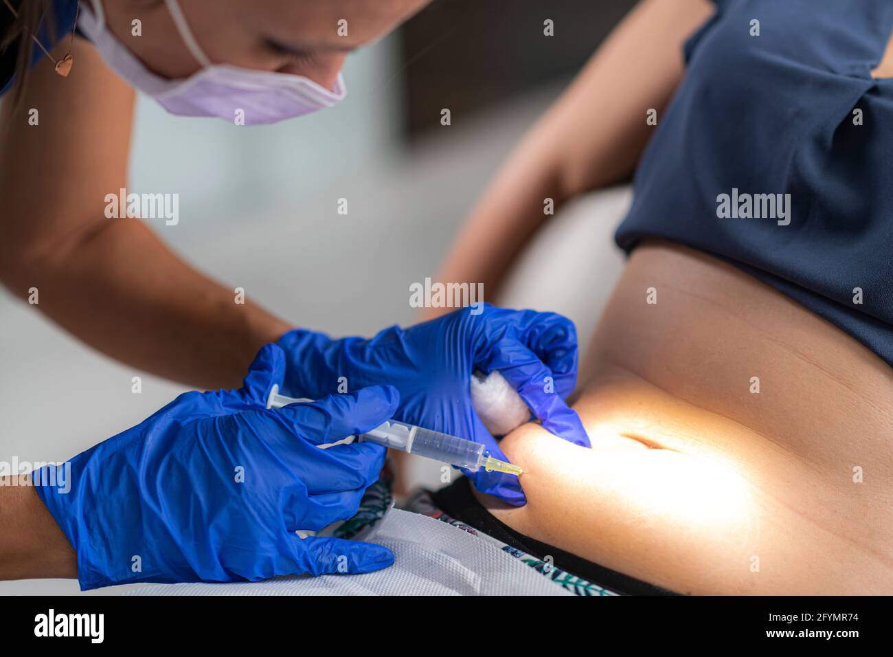 Lipolyse par injection Banque de photographies et d’images à haute ...