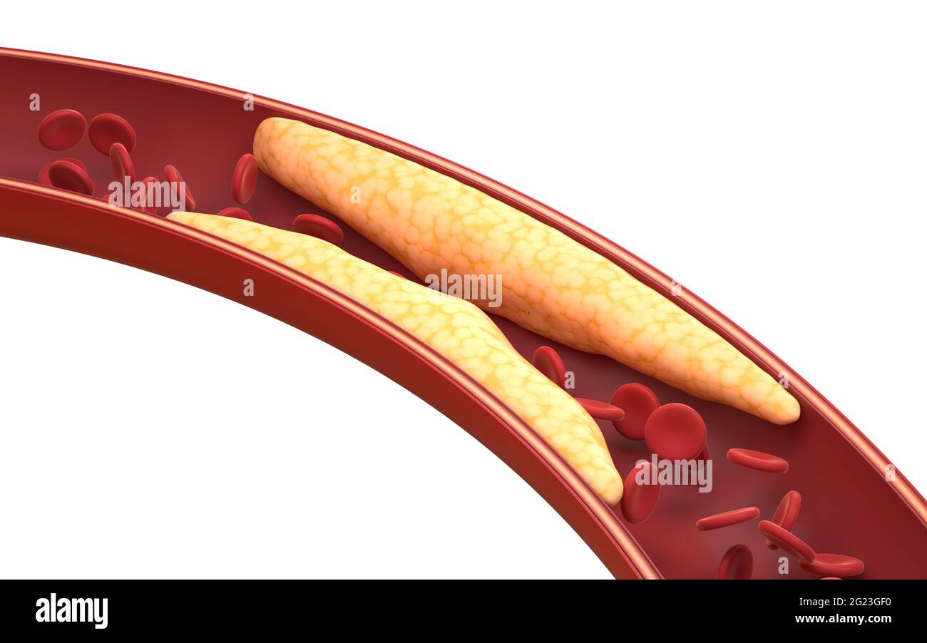 Globules rouges et gras dans les vaisseaux sanguins, rendu 3d. Dessin ...