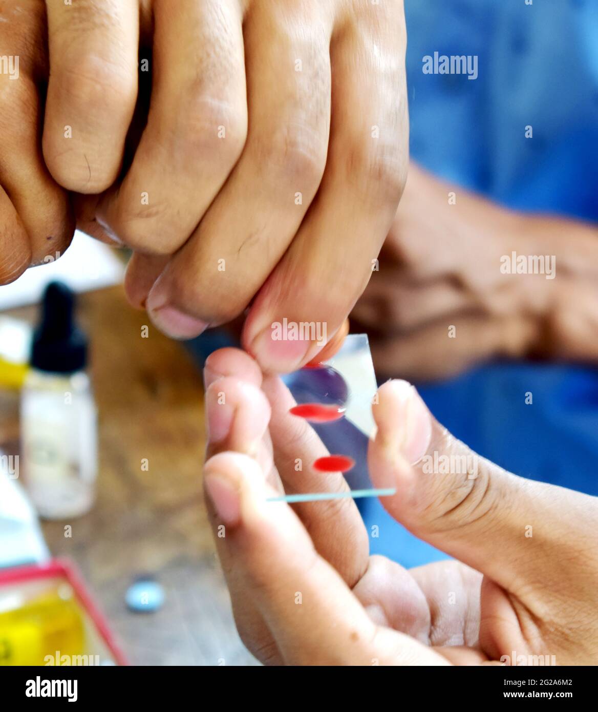 Dosage du groupe sanguin, groupage sanguin, groupe sanguin et test du ...