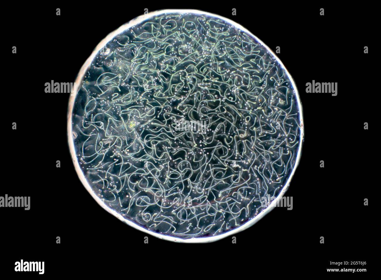 Cyanobacteria microscope Banque de photographies et d’images à haute ...