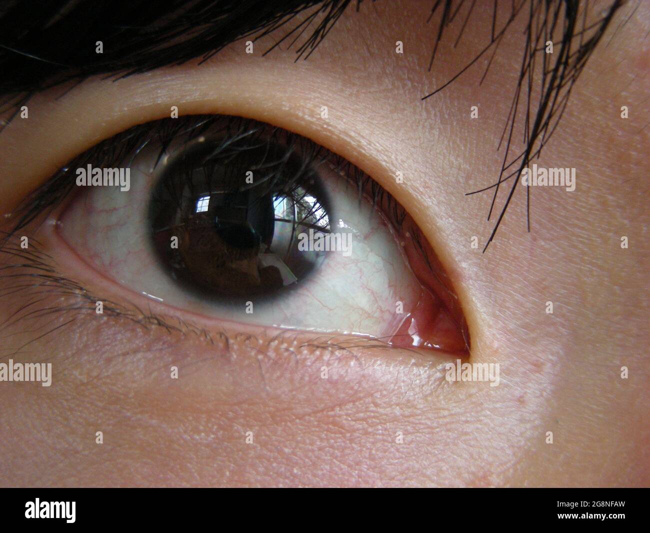 Pli cutané Banque de photographies et d’images à haute résolution ...