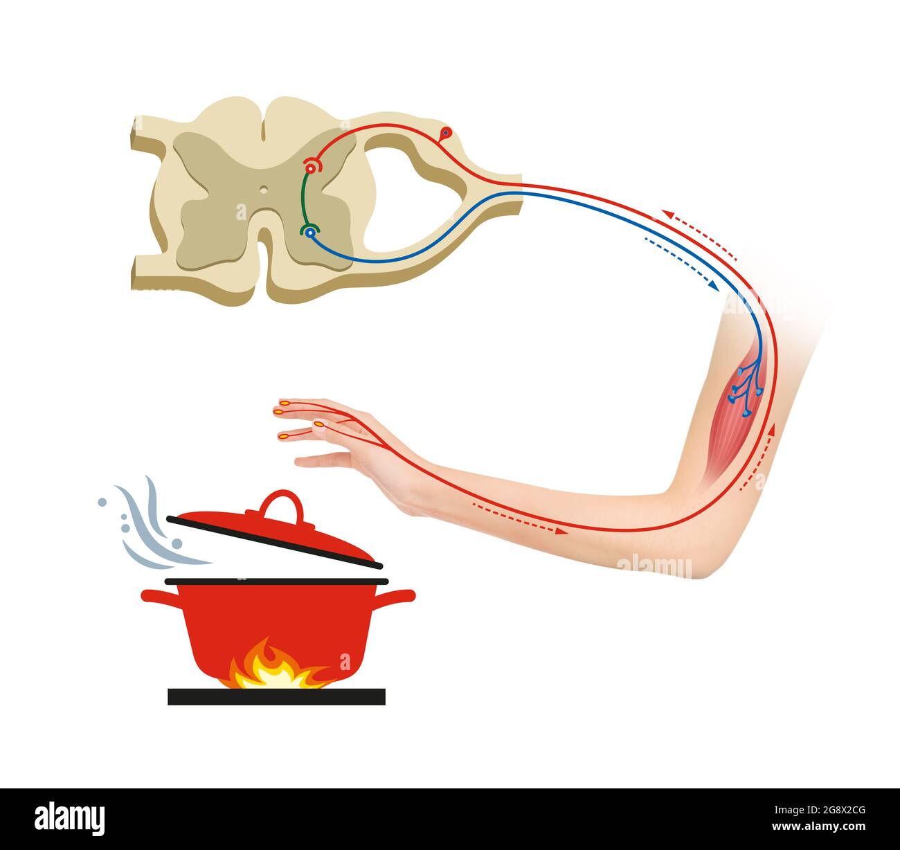 Réflexe musculaire Banque de photographies et d’images à haute ...
