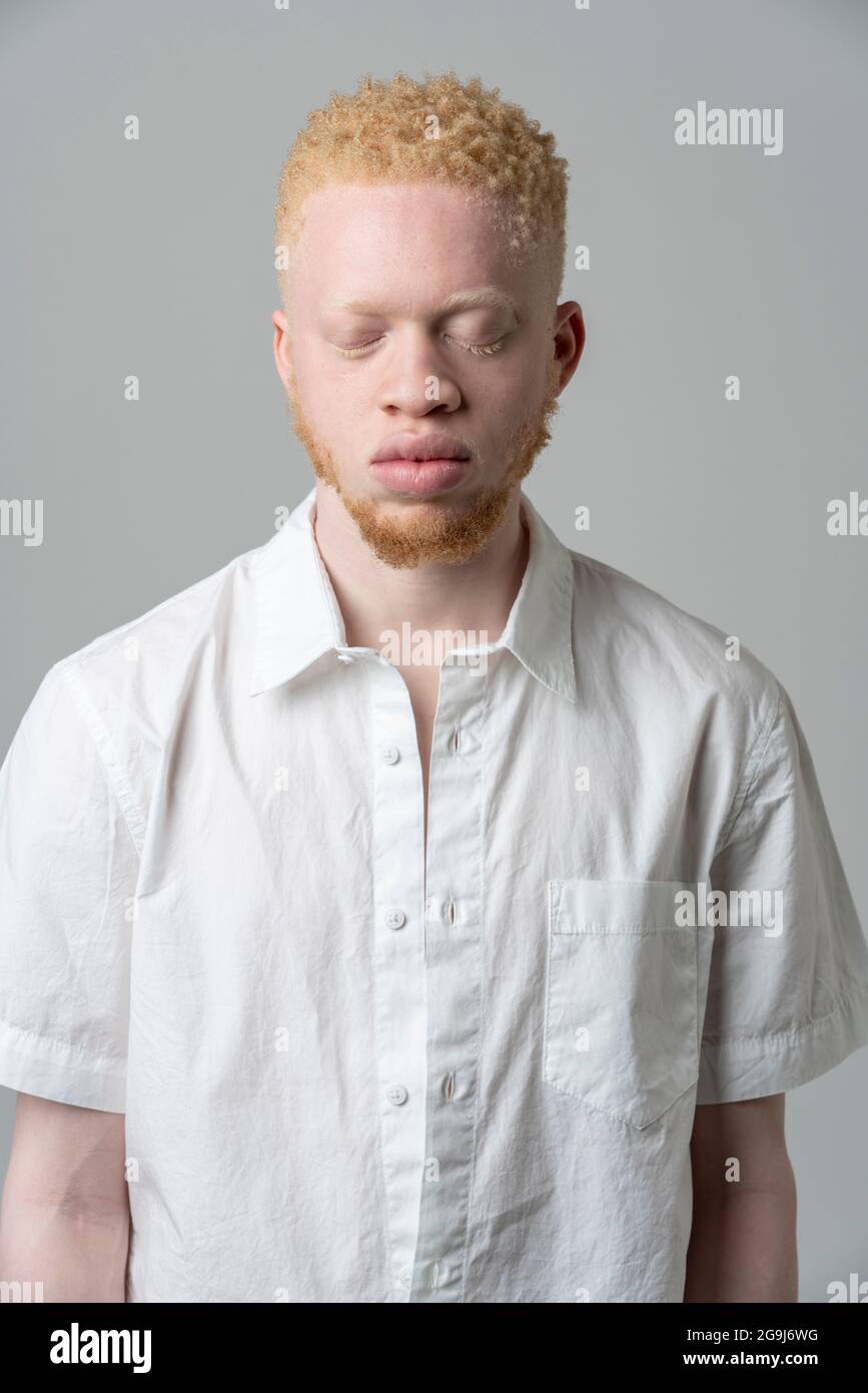 Studio portrait de l'homme albino en chemise blanche avec les yeux ...