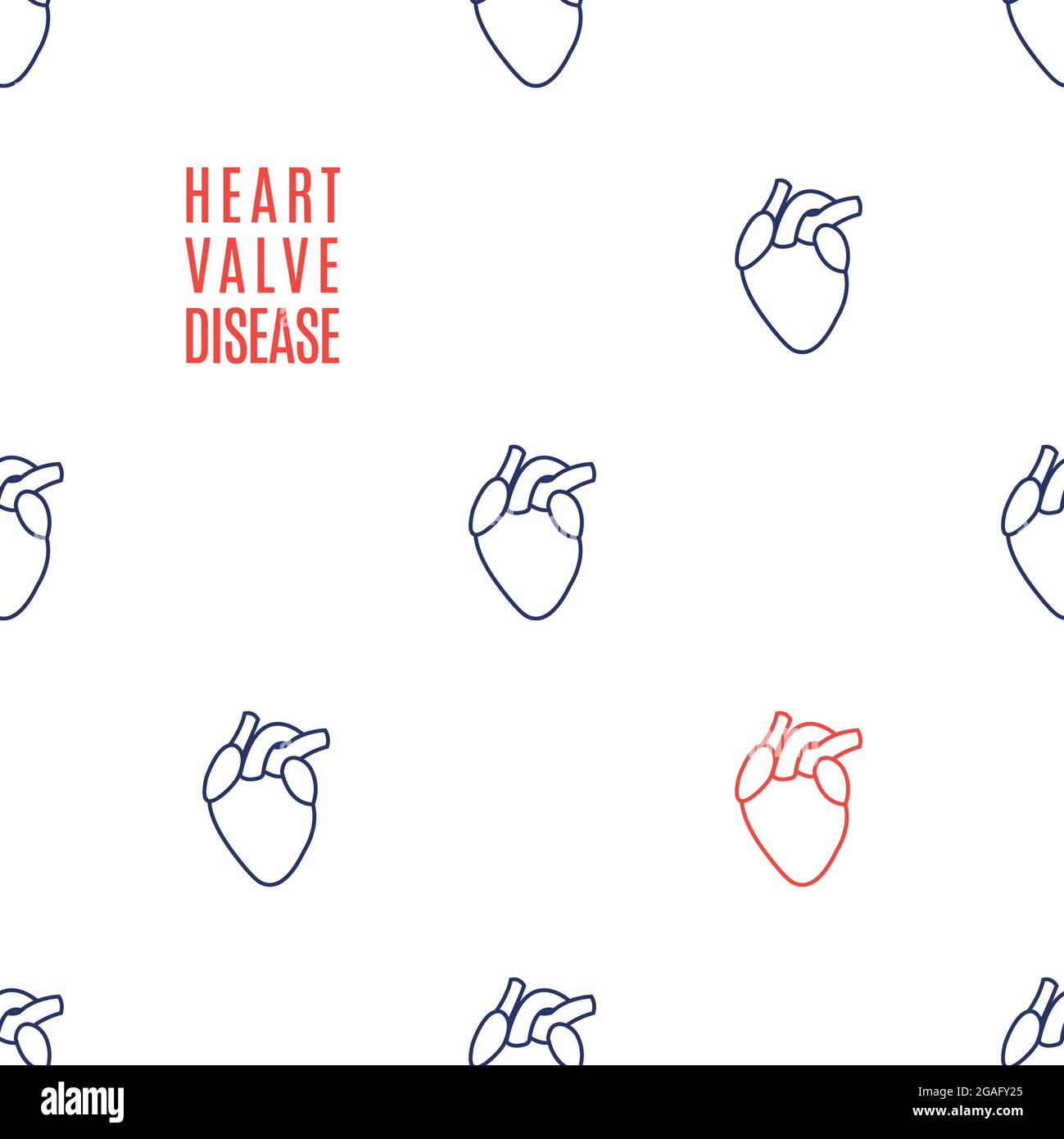 Insuffisance valvulaire cardiaque Banque d'images détourées - Alamy