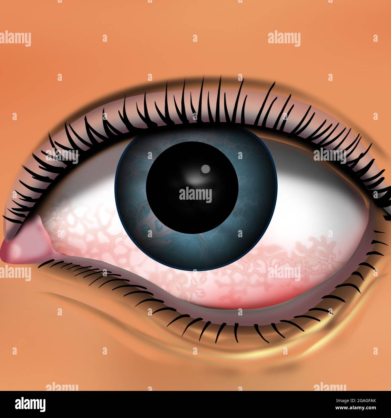 Irritation des yeux Banque de photographies et d’images à haute ...