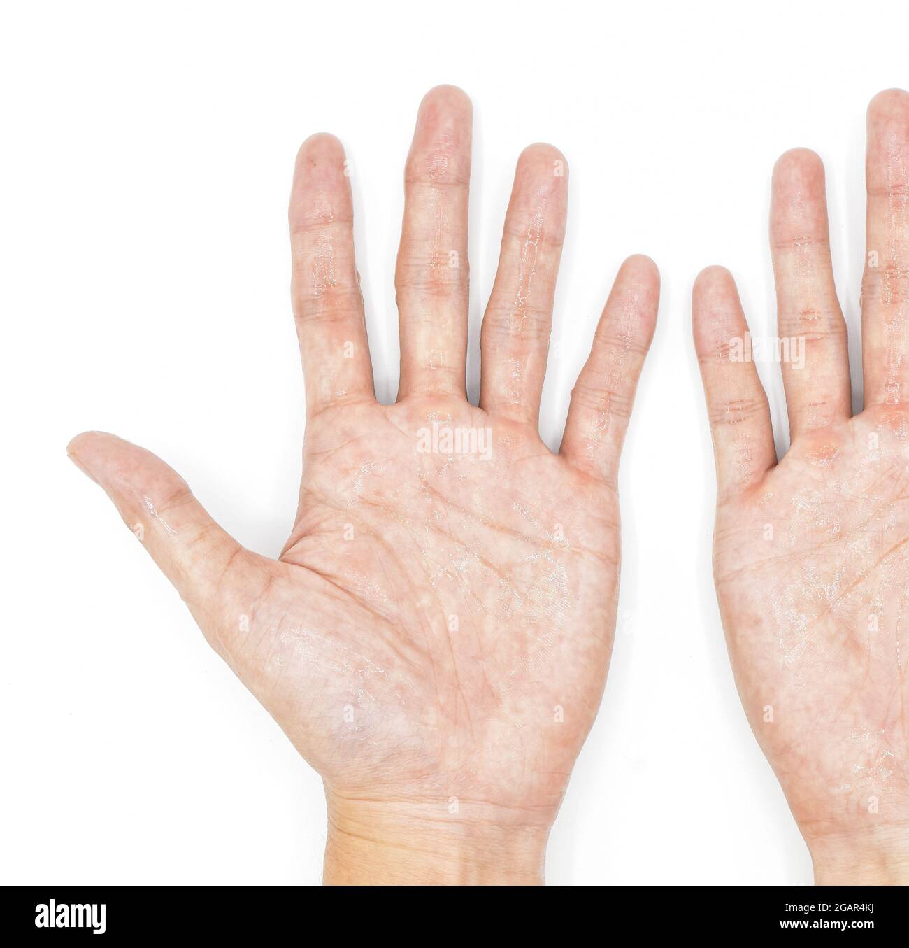 Homme en sueur Banque de photographies et d’images à haute résolution ...