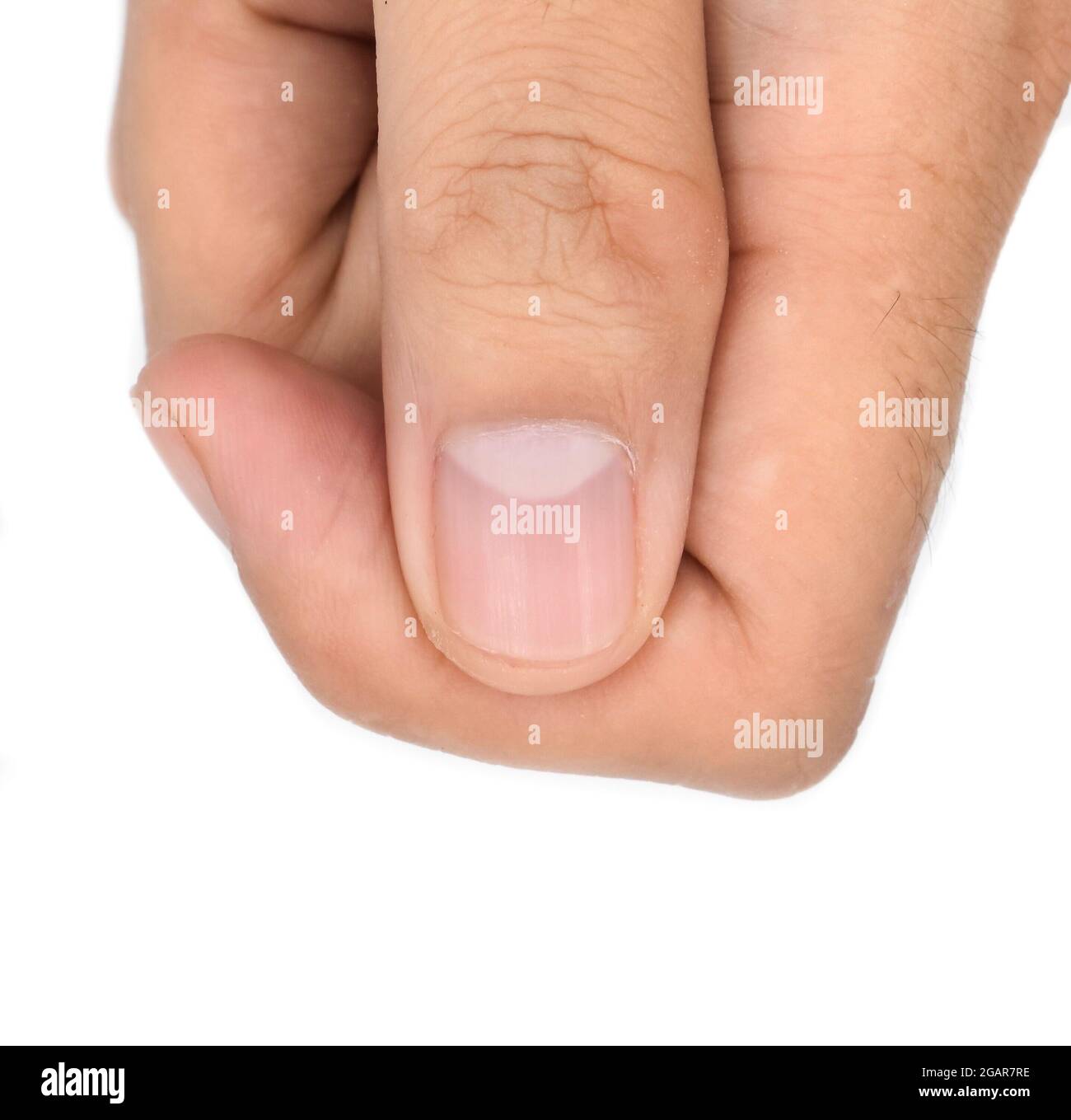 Gros lunulae ou demi-lune à l'ongle du pouce avec des lignes ...