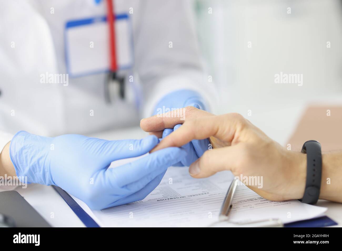 Skin rash eczema on hands Banque de photographies et d’images à haute ...