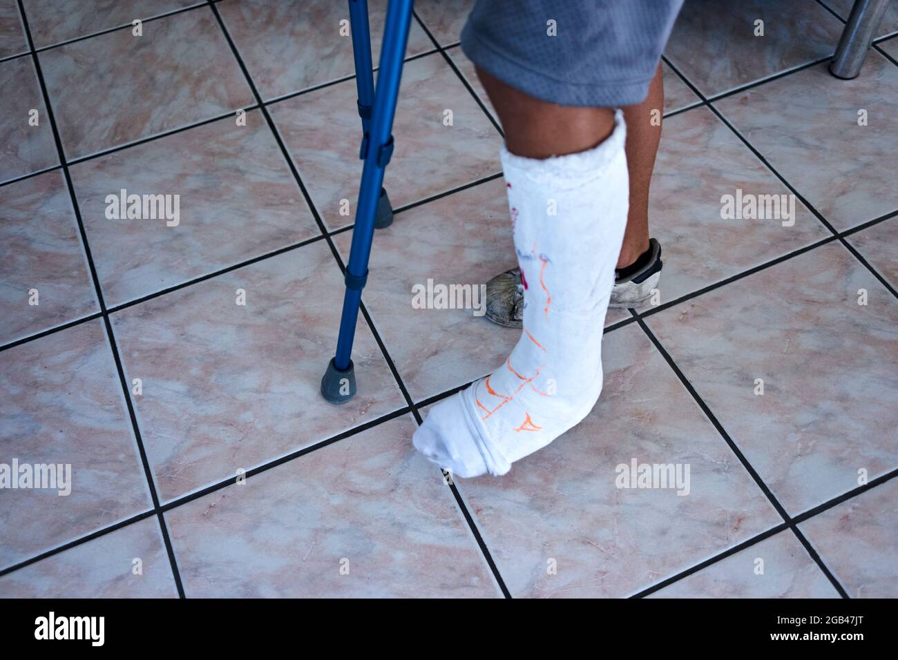 Pied De Jambe En Plâtre Banque De Photographies Et Dimages à Haute