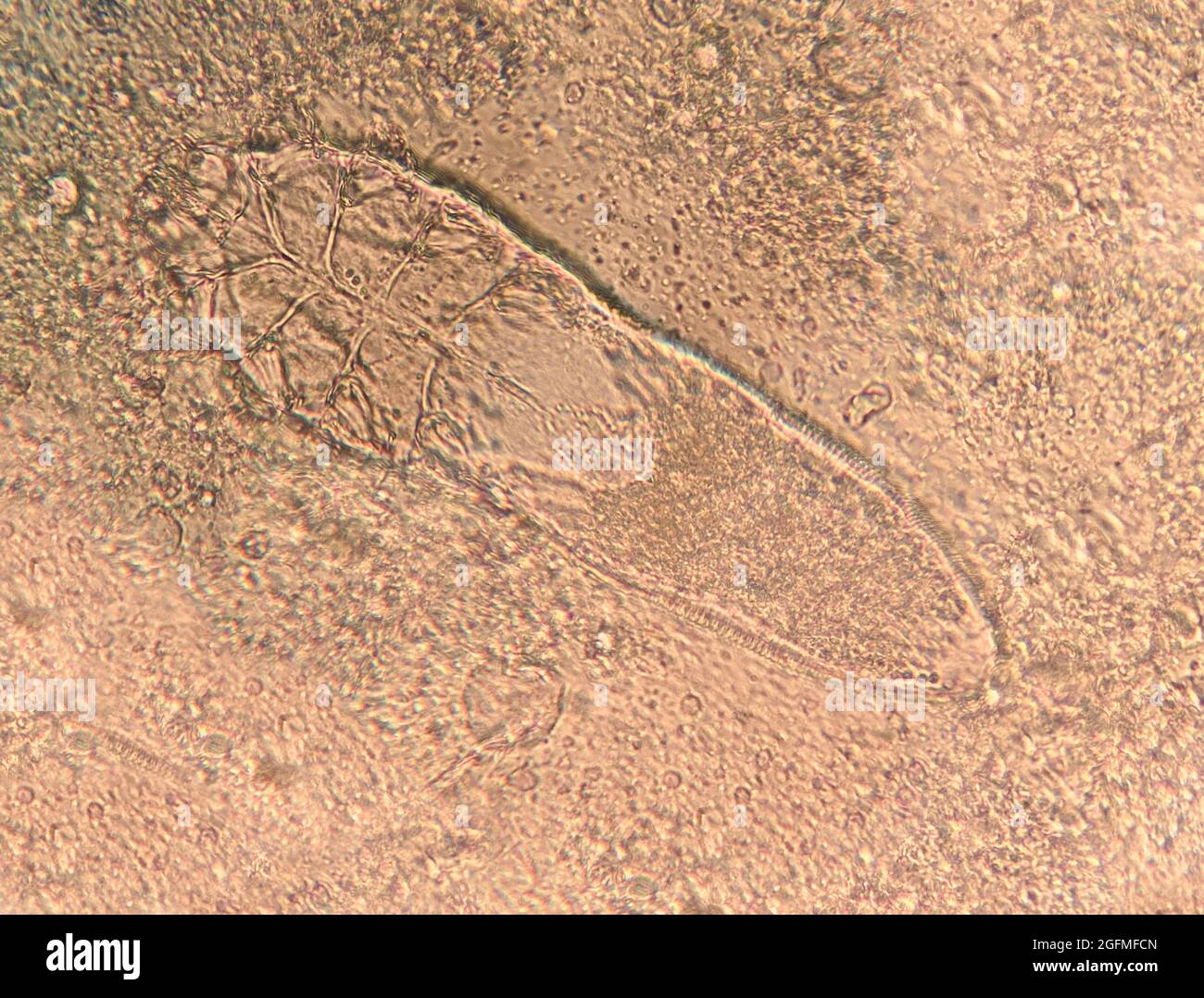 Parasites cutané follicule Banque de photographies et d’images à haute ...