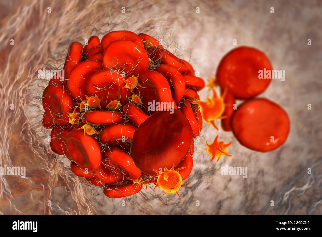 Caillot sanguin Banque de photographies et d’images à haute résolution ...