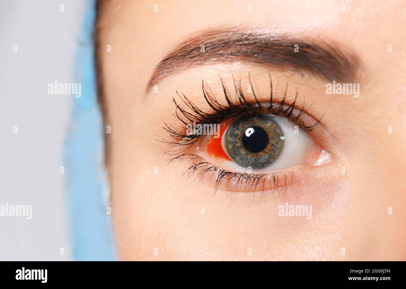 Maladie des troubles de la pupille Banque de photographies et d’images ...