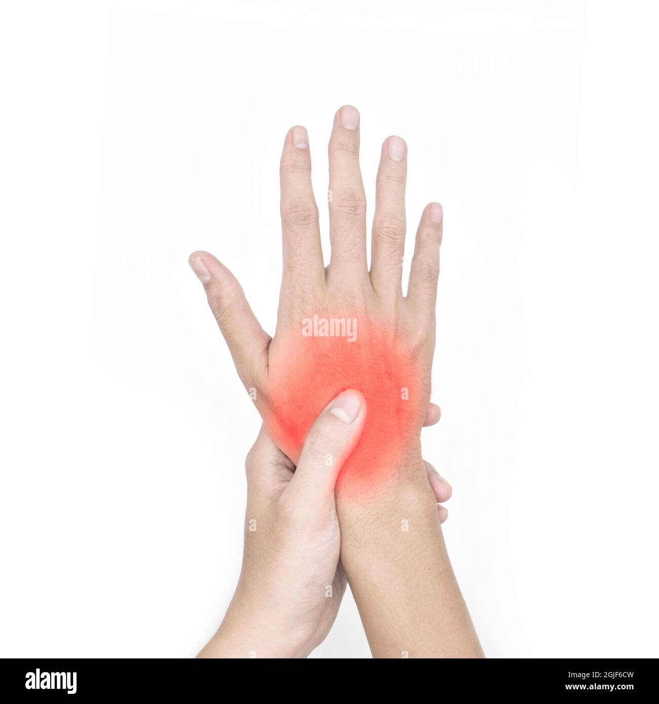 Rougeurs sur les mains Banque de photographies et d’images à haute ...