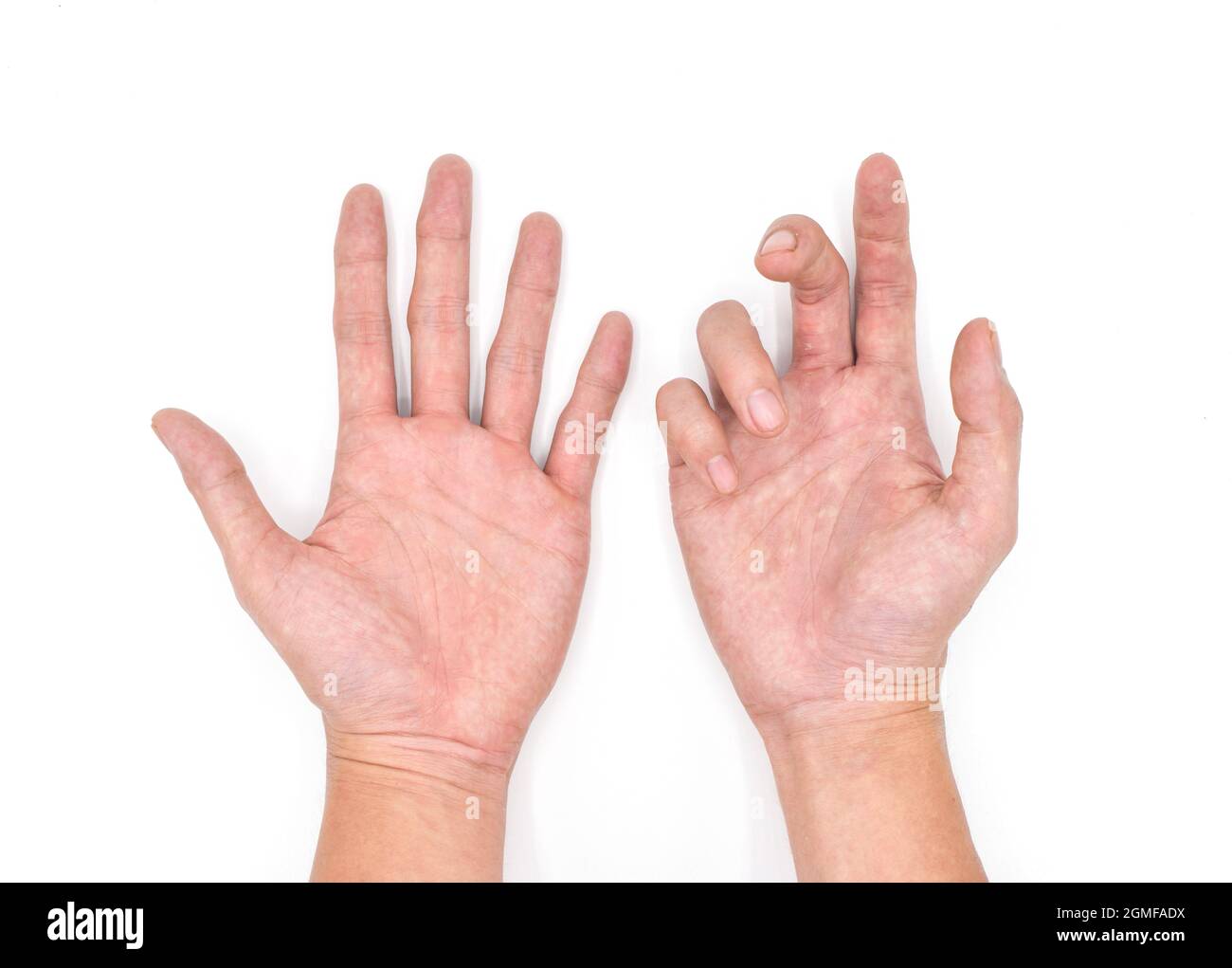 Griffe des mains Banque d'images détourées - Alamy