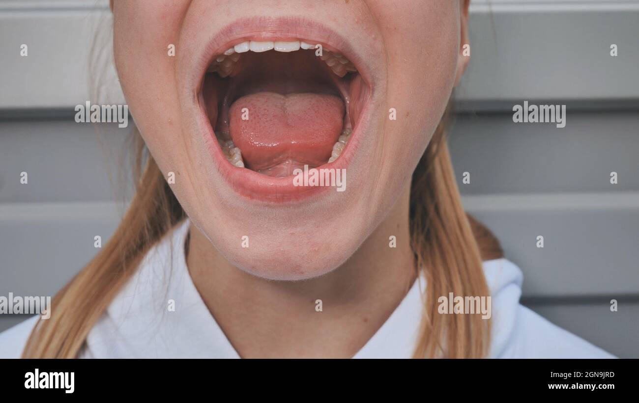 La jeune fille ouvre sa bouche et montre sa langue. Thème Stamatologie Photo Stock - Alamy