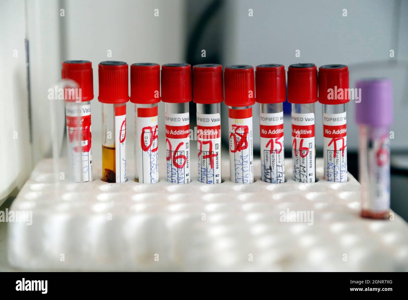 Tubes de sang vacutainer Banque de photographies et d’images à haute ...