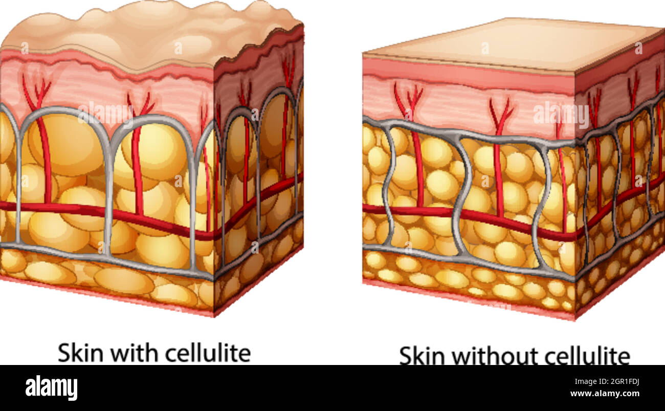 Dermis dibujo Banque d'images vectorielles - Alamy