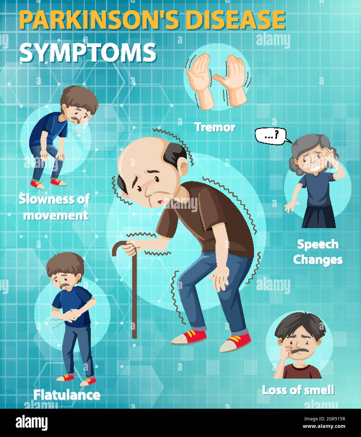 Infographie sur les symptômes de la maladie de Parkinson Image ...