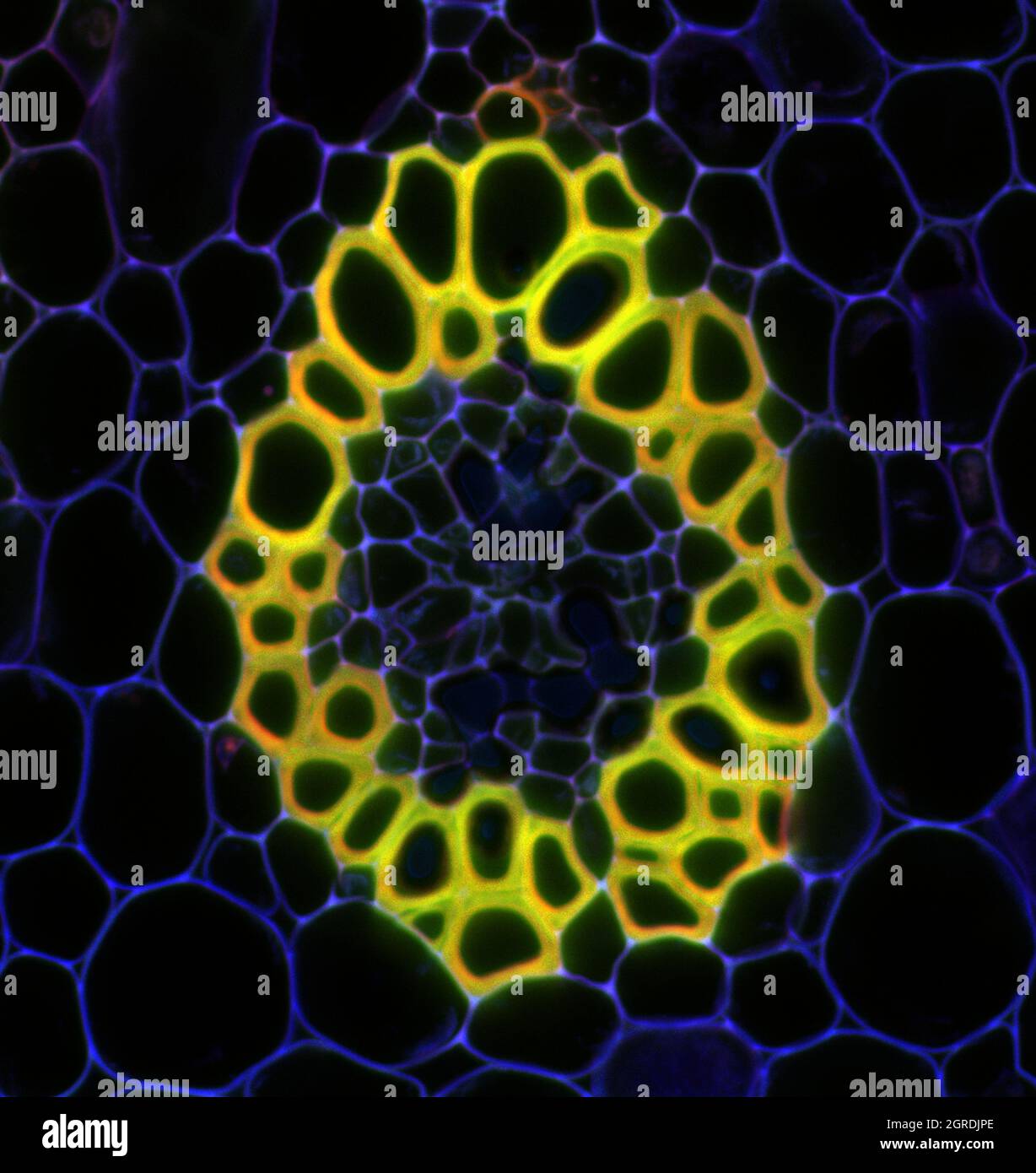 Échantillon microscopique de plantes Convallaria, signal de ...