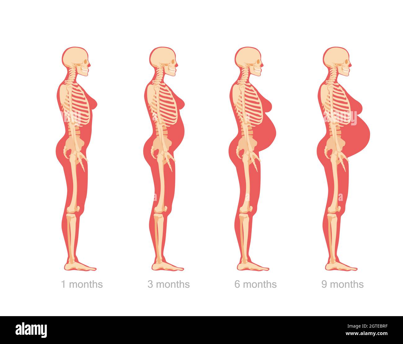 Étapes de l'élargissement abdominal chez la femme enceinte. Structure ...