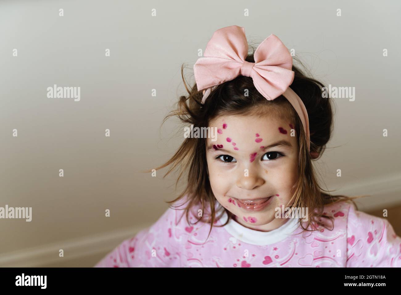 Taches brunes peau humaine Banque de photographies et d’images à haute ...