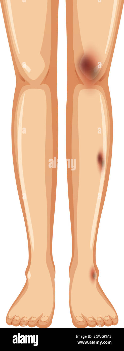 Jambes de dessin Banque d'images vectorielles - Alamy