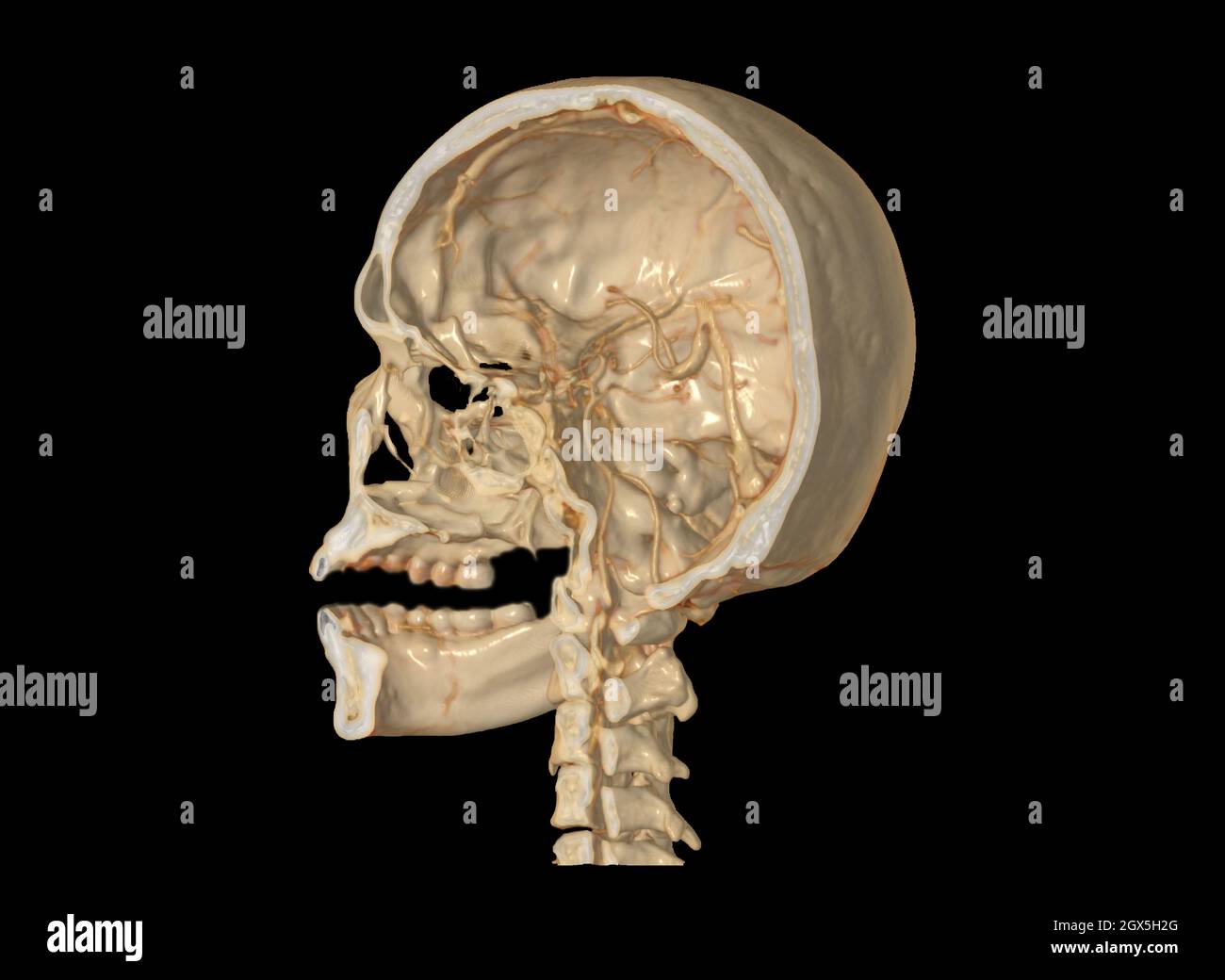 Un arrière du crâne 3D montrant le cerveau à l'intérieur du crâne Photo ...