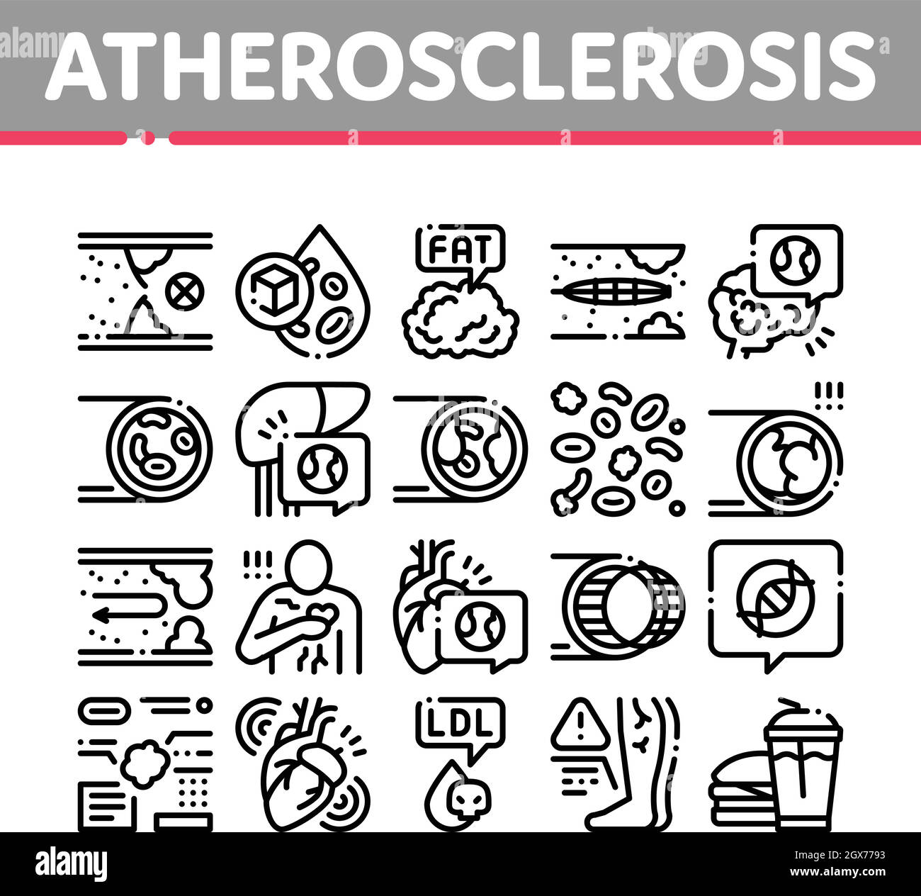 Athérosclérose Banque d'images vectorielles - Alamy