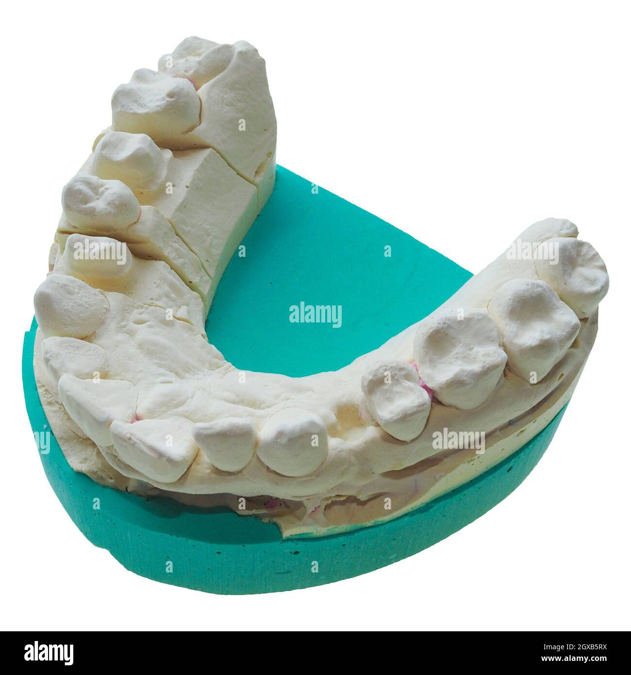 Moule dentaire Banque de photographies et d’images à haute résolution ...