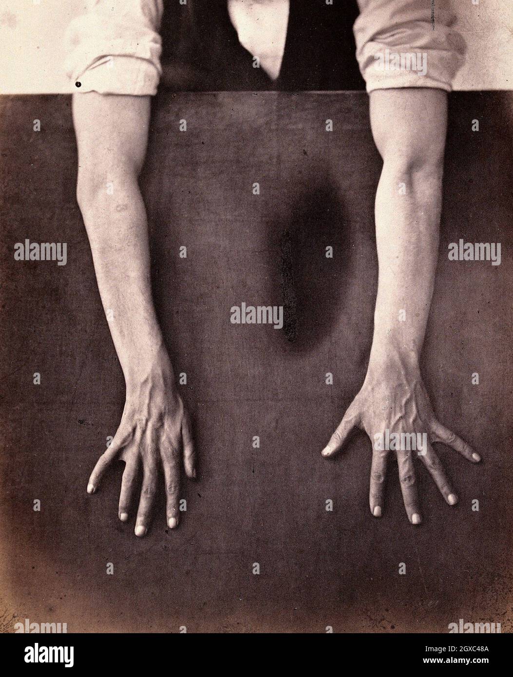 Technique de la main droite Banque de photographies et d’images à haute ...