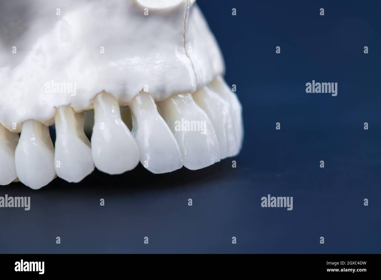 Les dents de la mâchoire supérieure avec l'anatomie médicale modèle ...