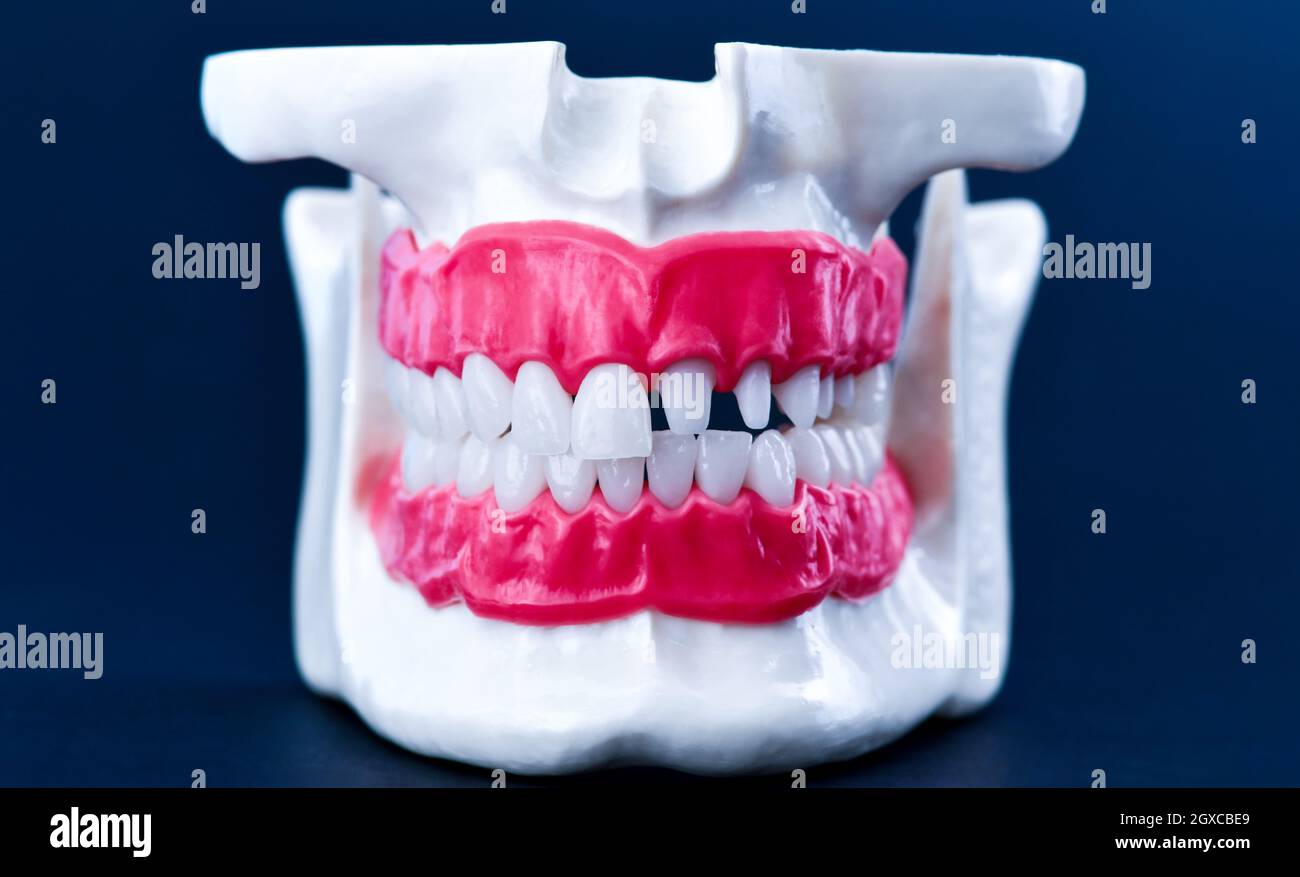 Mâchoire humaine avec l'anatomie des dents et des gencives en illustration médicale modèle isolé ...