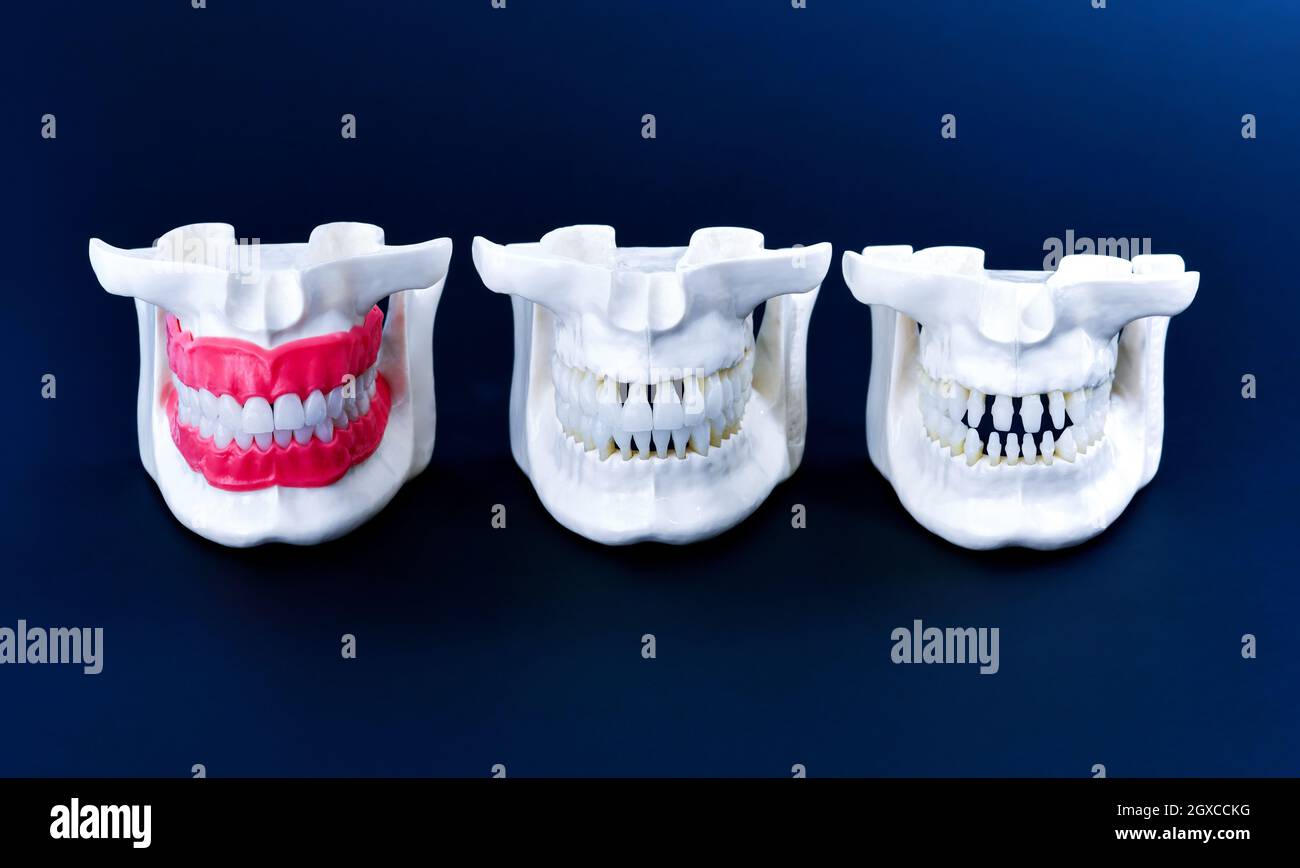 Les mâchoires à dents et gencives modèles anatomie medical illustration ...